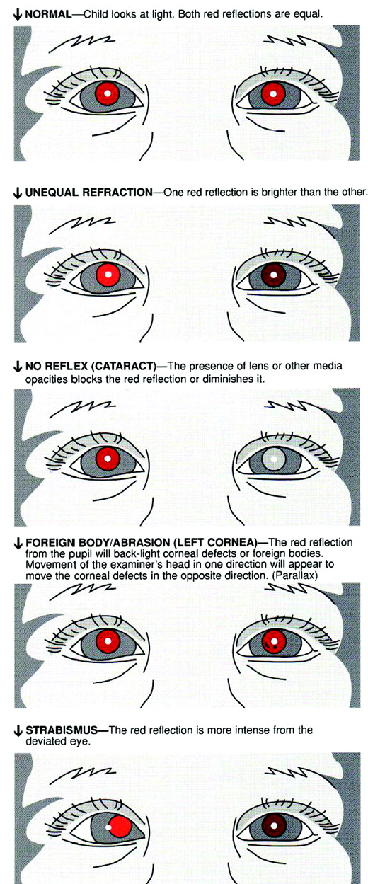 Red Reflex – Welcome